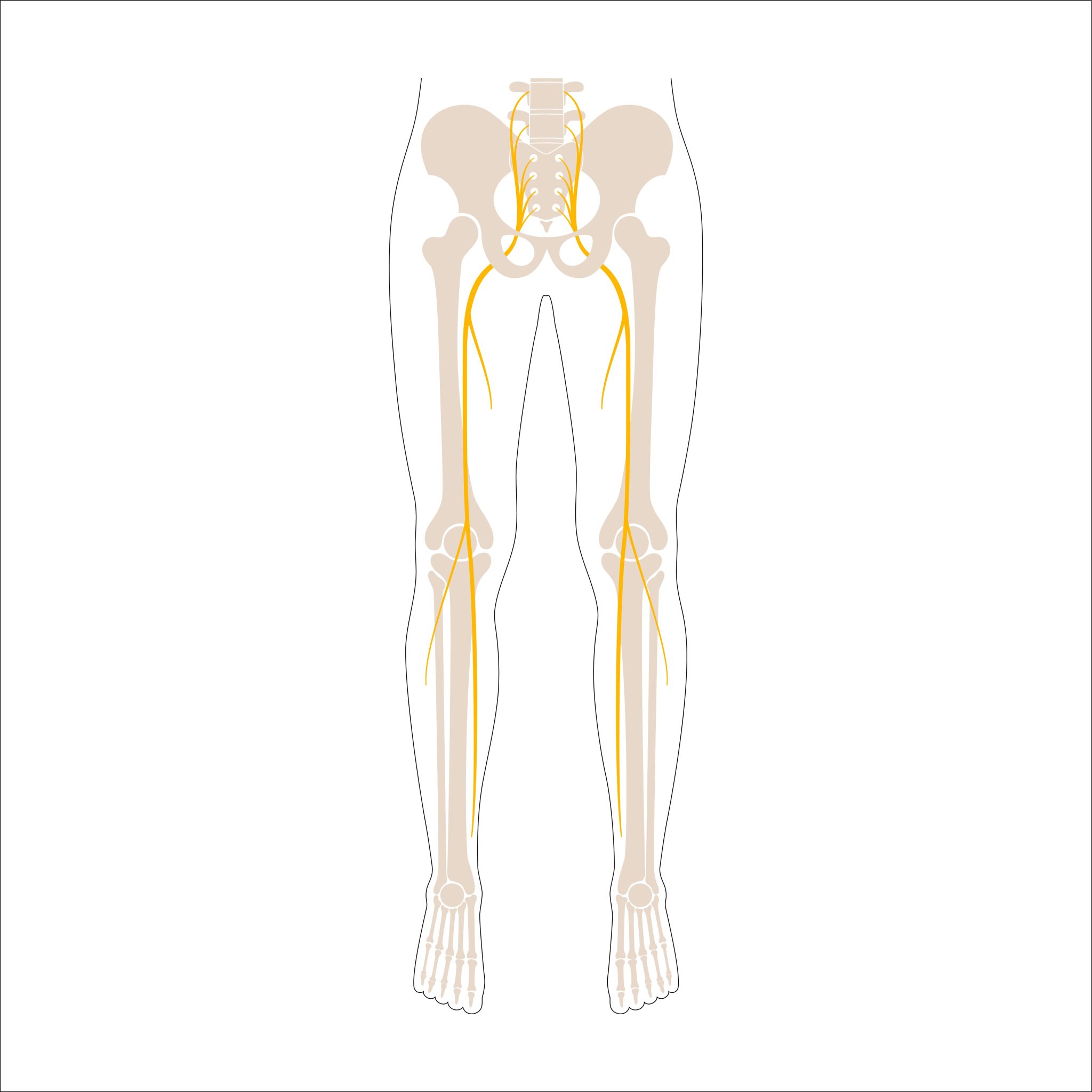 Síndrome do Piriforme - Ceimec
